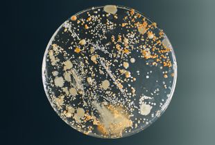 Georgia Sandy - Bacterial Veneer | LensCulture