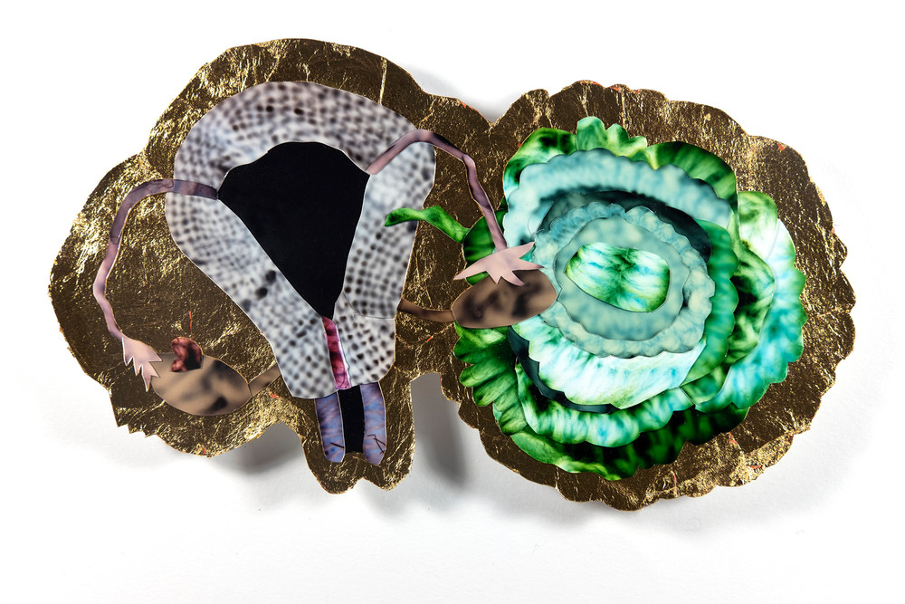 Rachael Jablo - The Hysteria Project | LensCulture