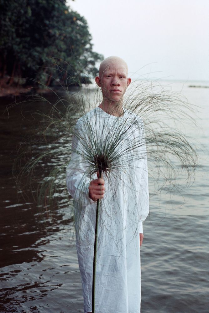 Denisse Ariana Perez - "Albinism, Albinism" - An Exploration of Light ...