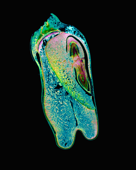 Jennifer Formica - Microcosmic Nature | LensCulture