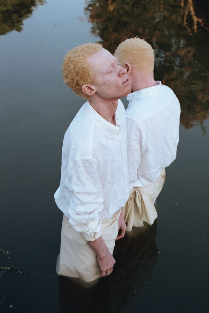 Denisse Ariana Perez - "Albinism, Albinism" - An Exploration of Light ...