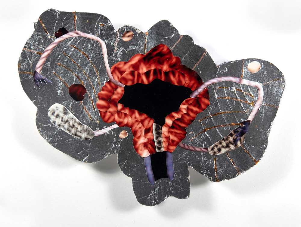 Rachael Jablo - The Hysteria Project | LensCulture