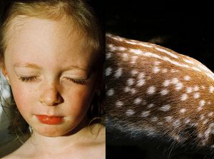 Milk Teeth - LensCulture